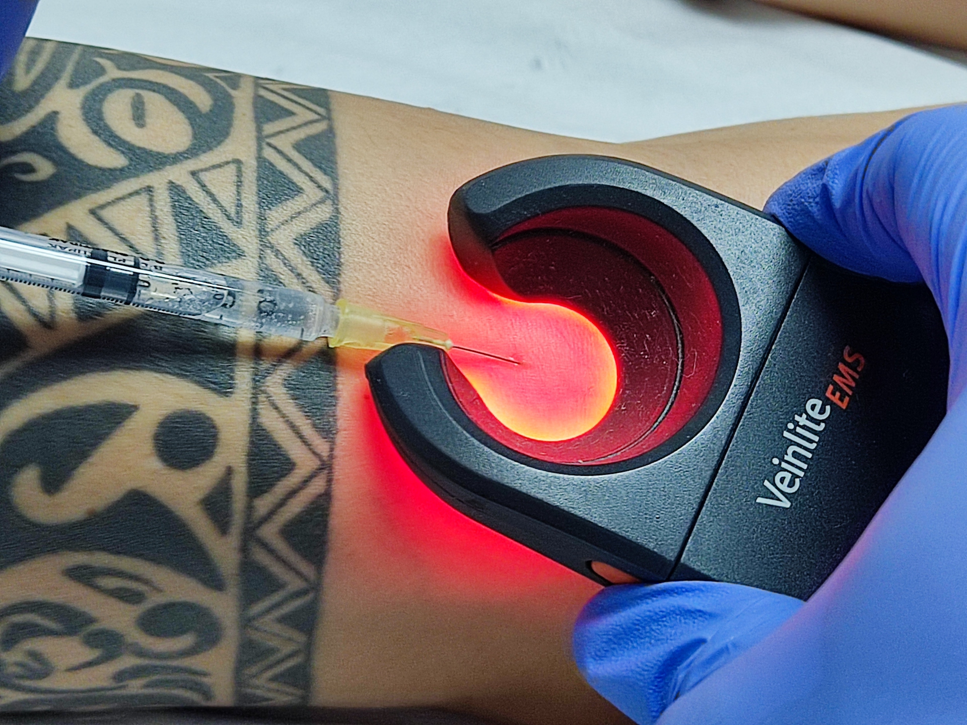 Várices: Mi historia real y lo que aprendí en el camino – barbierika